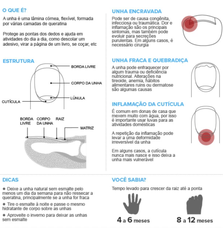 Unhas quebradiças, o que pode ser? 7 causas comuns e o que fazer